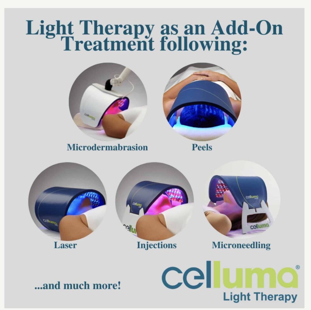 Celluma Light Therapy - Pretty Little Lies Aesthetics